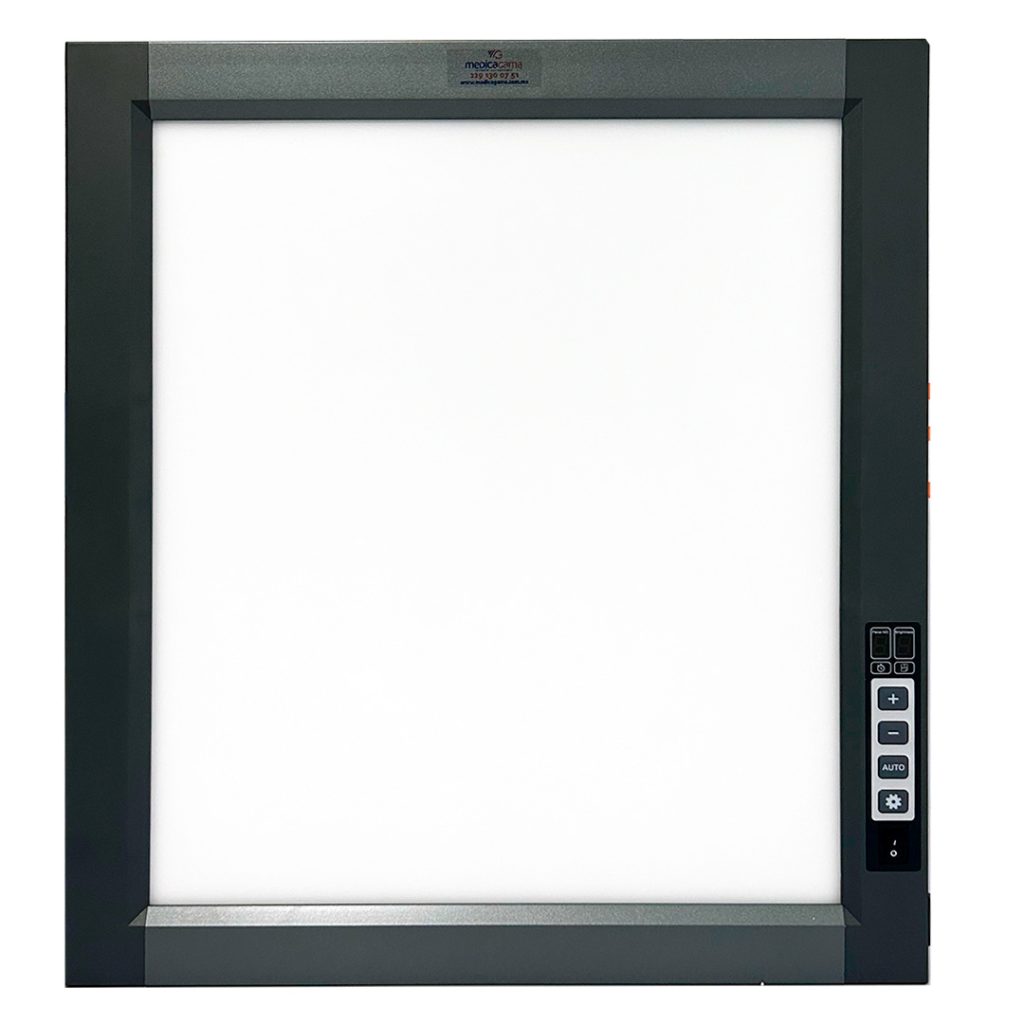 Negatoscopio Sencillo LED - MedicaGama