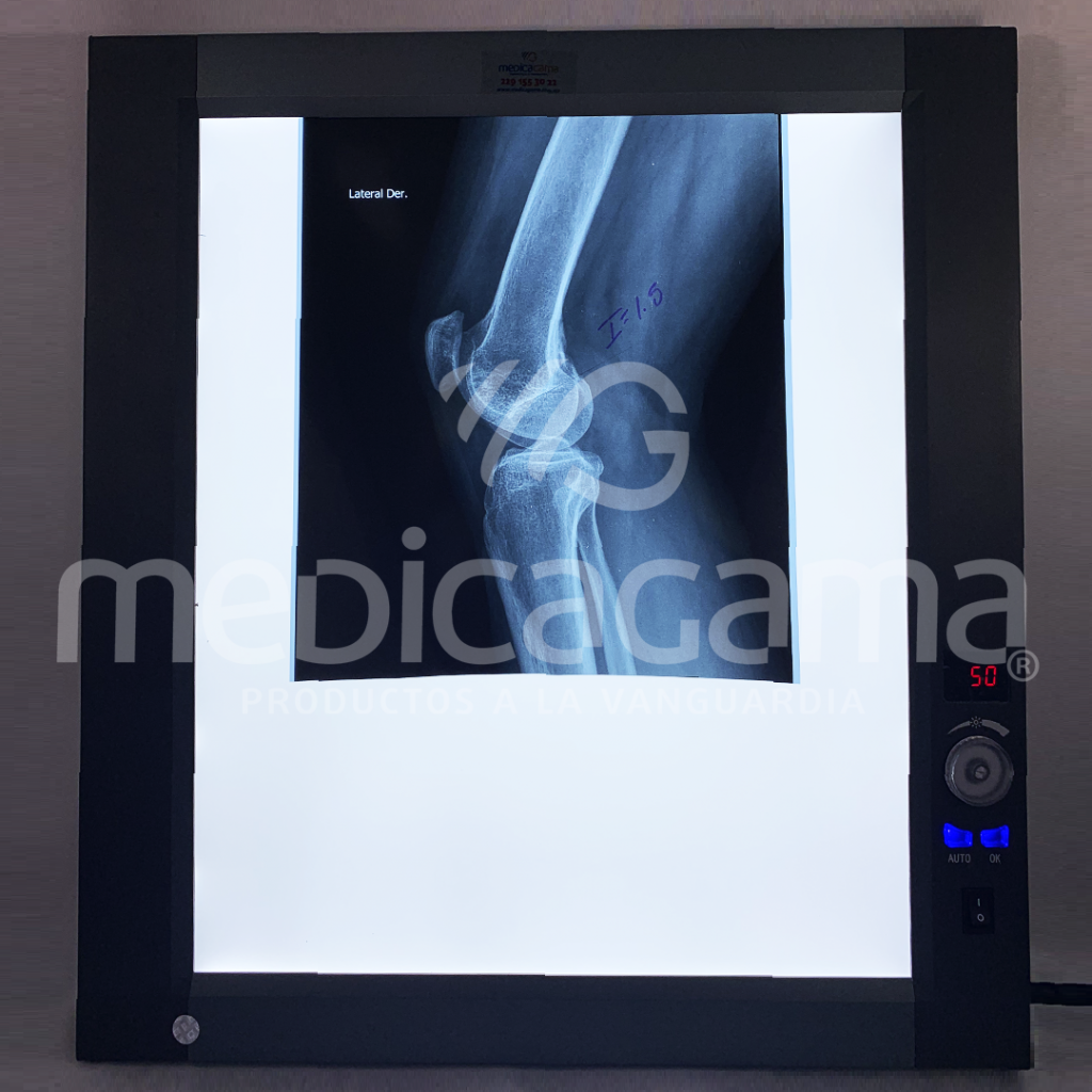 Negatoscopio Sencillo LED - MedicaGama