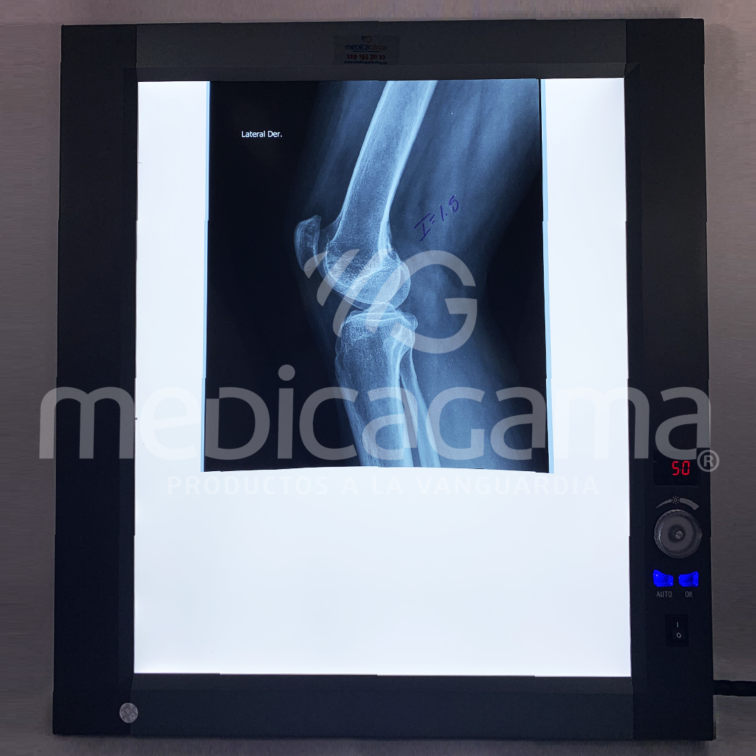 Negatoscopio Sencillo LED - MedicaGama