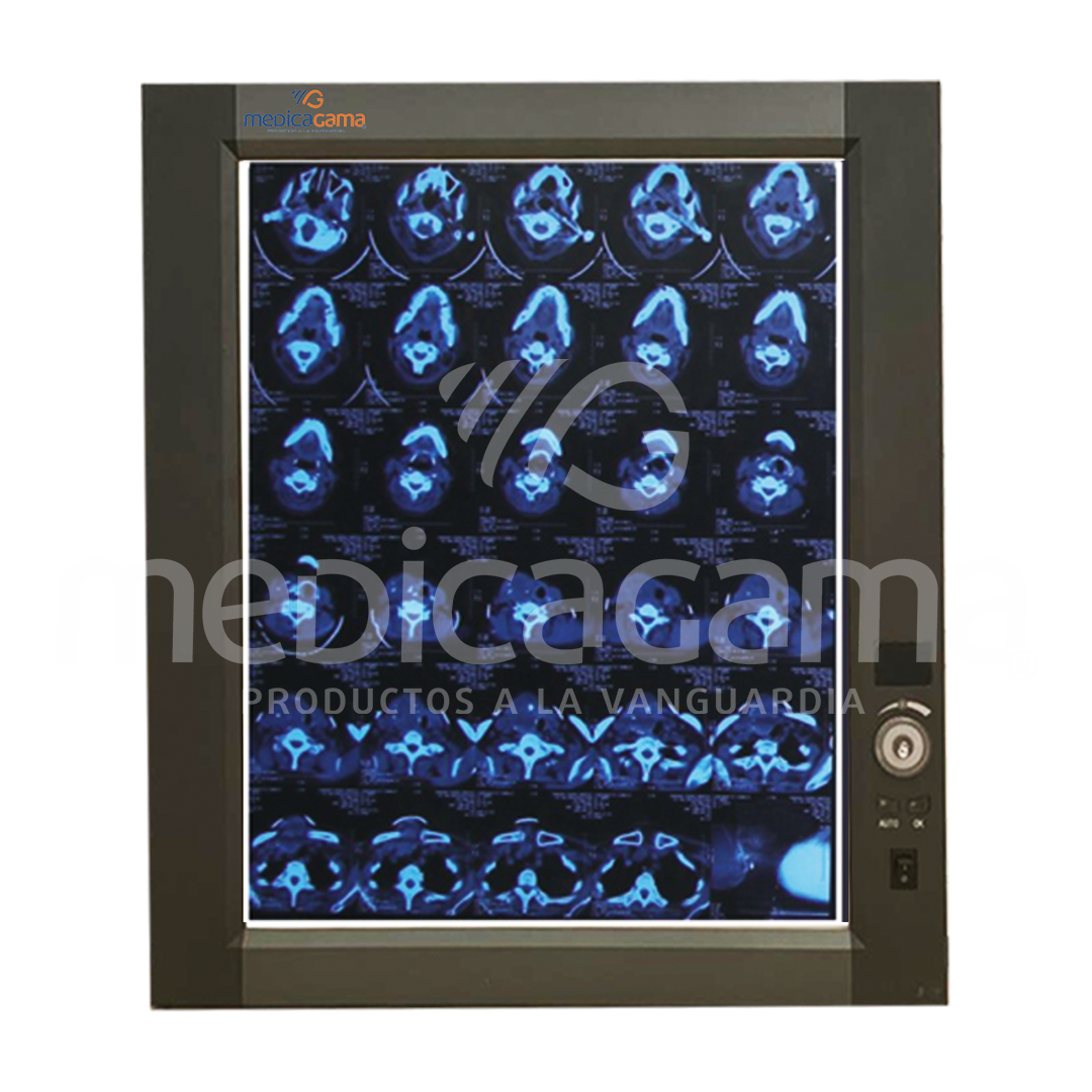 Negatoscopio Sencillo LED - MedicaGama