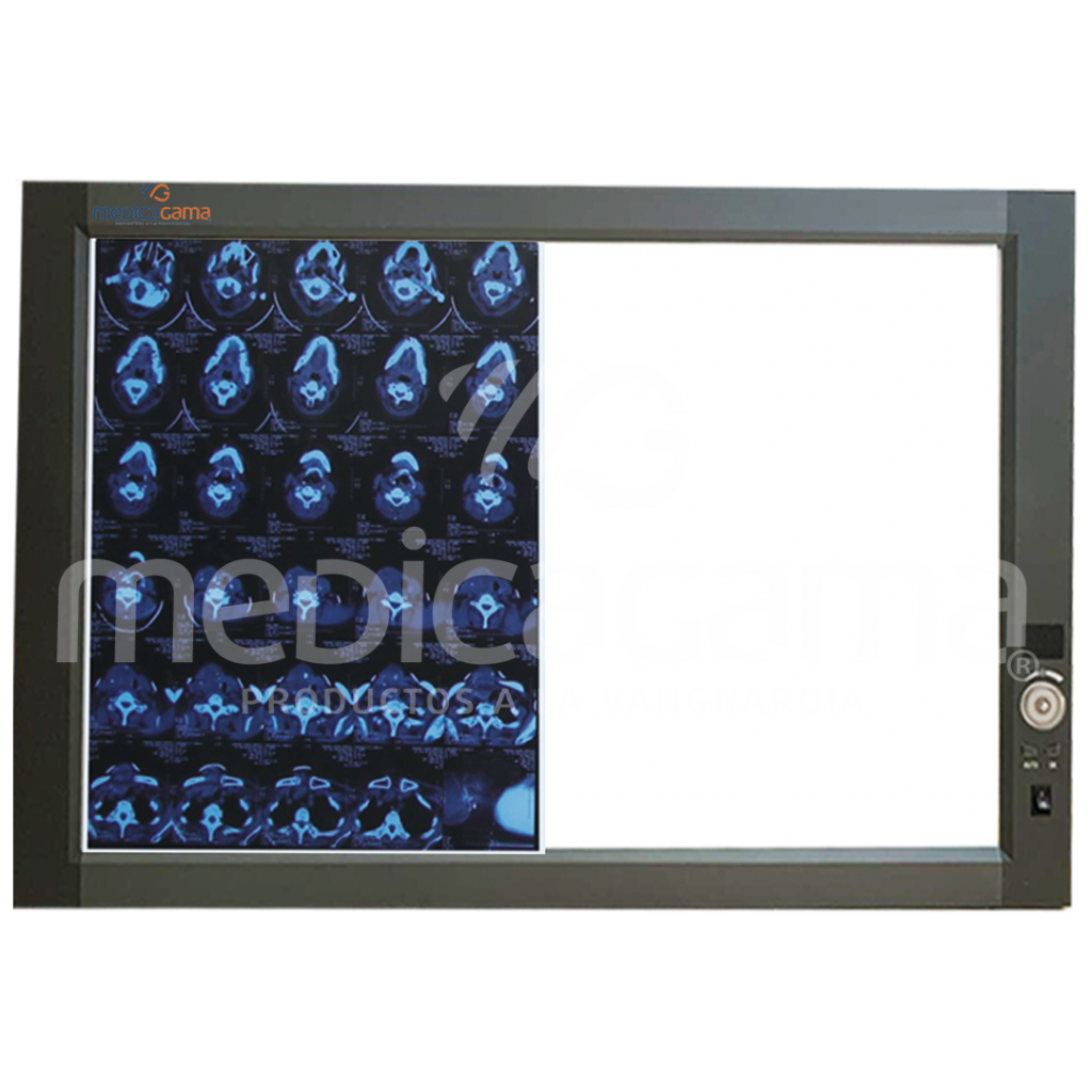 Negatoscopio Doble LED - MedicaGama