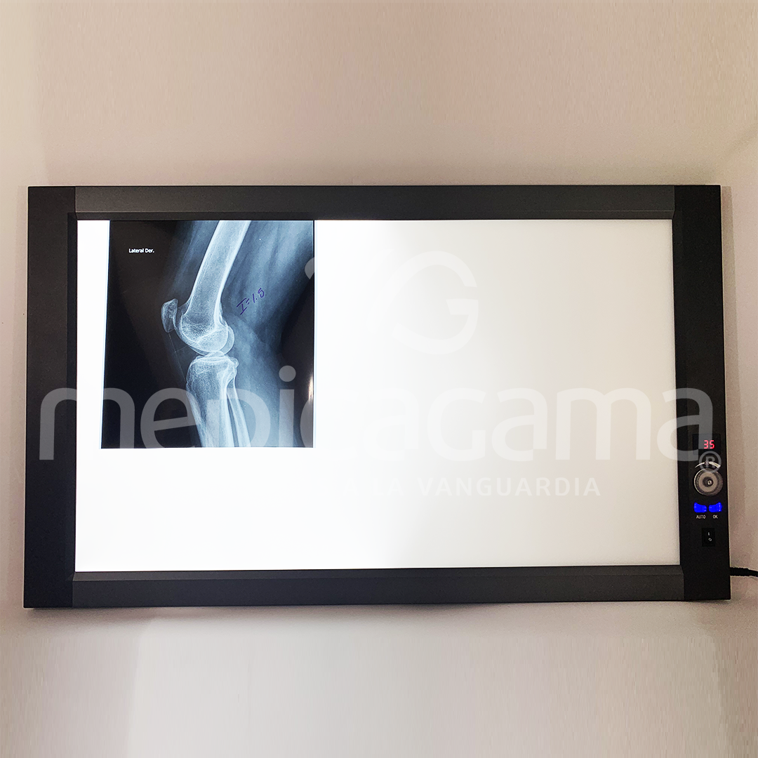 Negatoscopio Doble LED - MedicaGama
