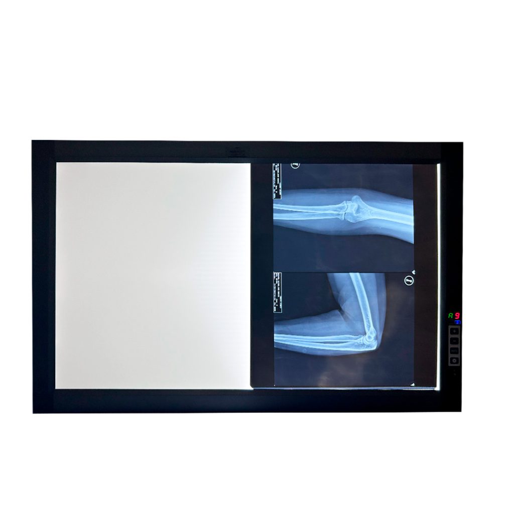 Negatoscopio Doble LED - MedicaGama