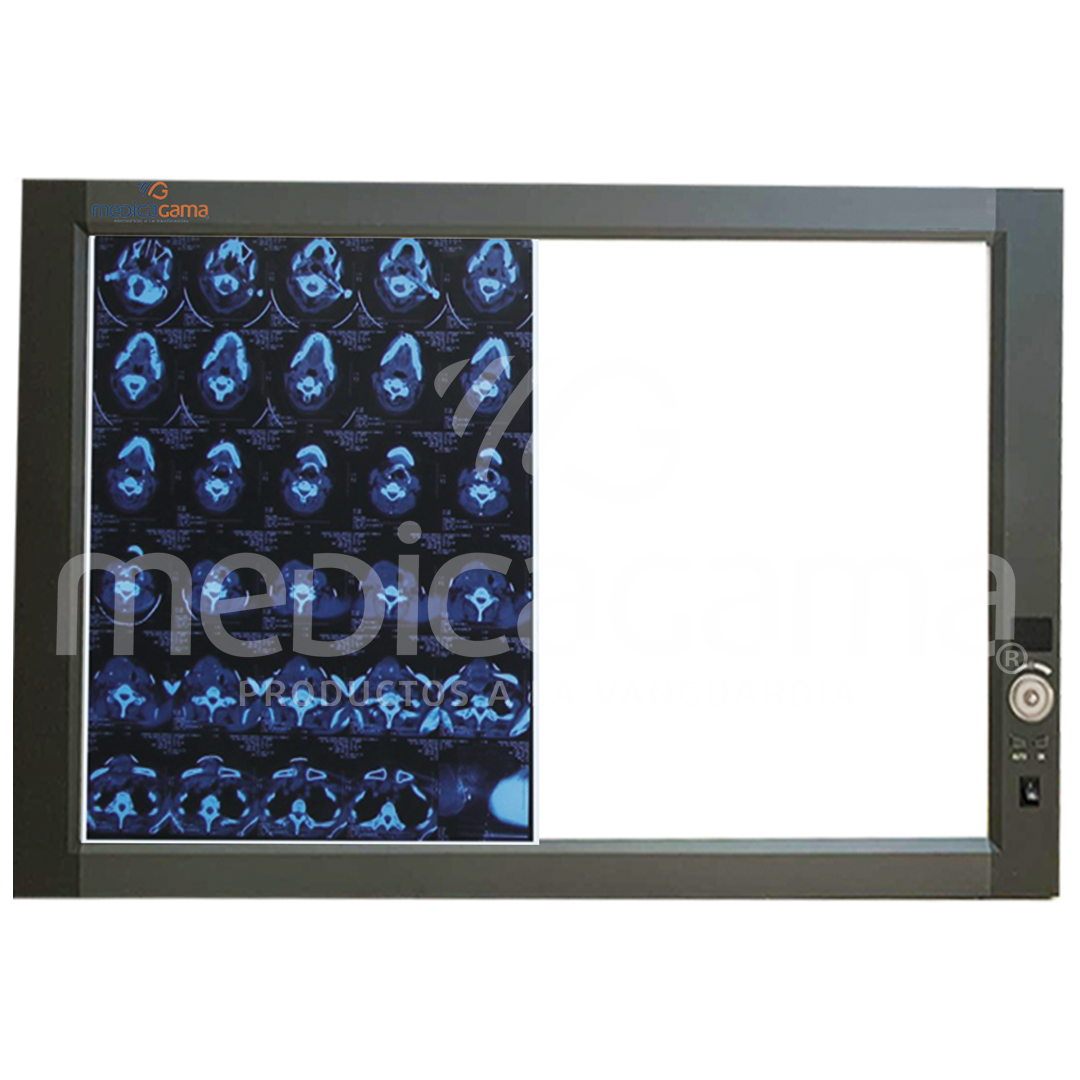 Negatoscopio Doble LED - MedicaGama